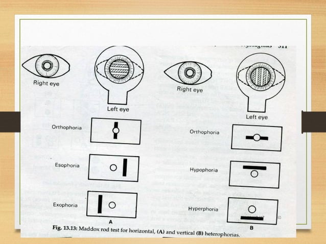 Prisms in optometry practice | PPT | Eye and Vision Conditions ...