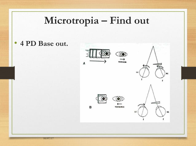 Prisms in optometry practice | PPT | Eye and Vision Conditions ...