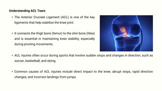 Pristyn Care - MRI in Diagnosing ACL Tears Image Techniques and ...
