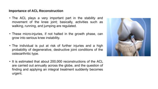 Pristyn Care Innovations in ACL Surgery The Development and Use of ...