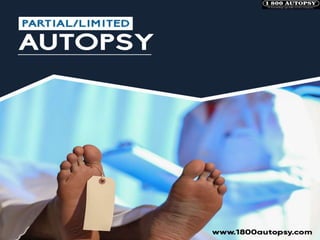 Private autopsy | PPT