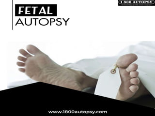 Private autopsy | PPT