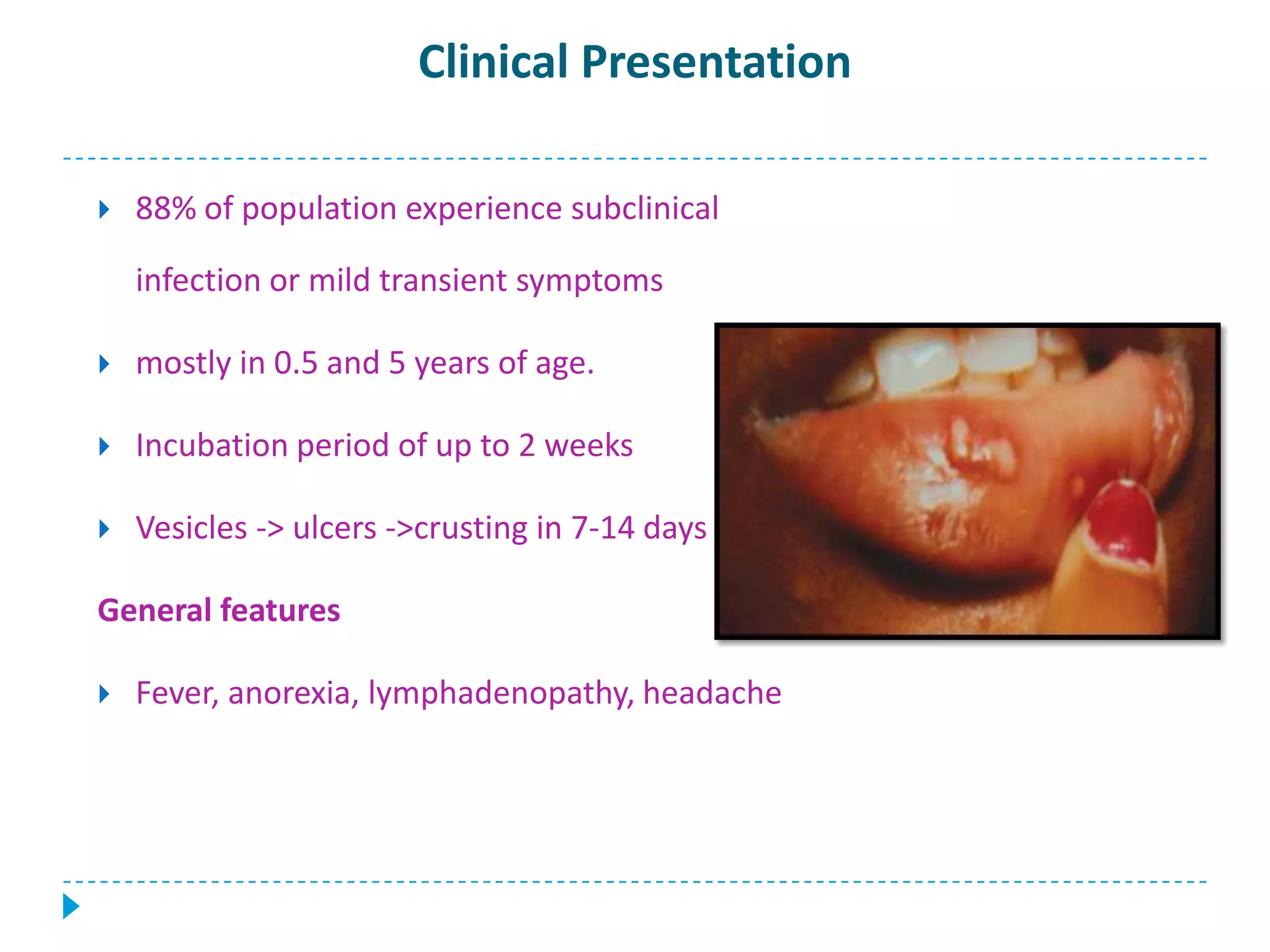 Priya seminar on ulcerative,vesicular and bullous lesions | PPTX