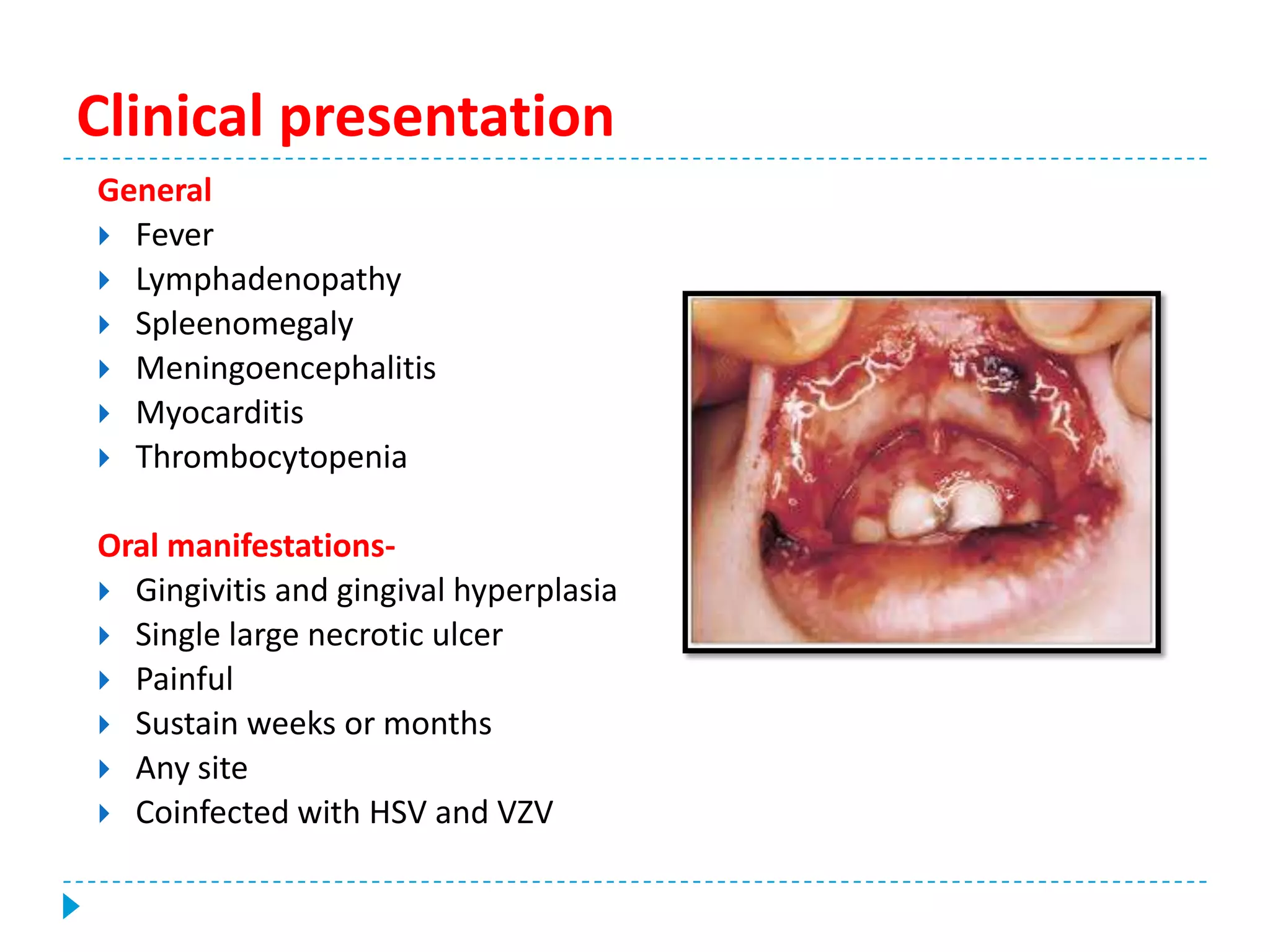 Priya seminar on ulcerative,vesicular and bullous lesions | PPTX