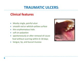 Priya seminar on ulcerative,vesicular and bullous lesions | PPTX
