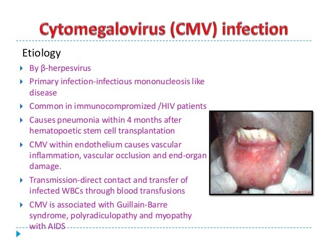 Priya seminar on ulcerative,vesicular and bullous lesions