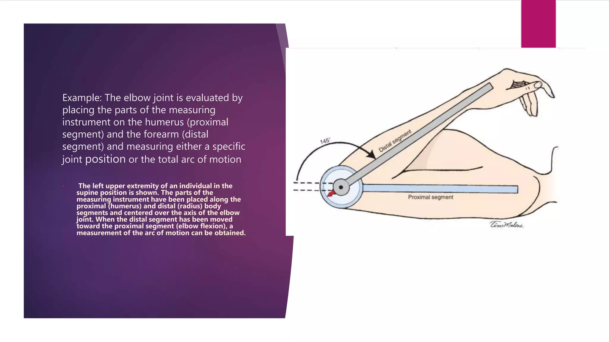 Goniometry of upper limb | PPTX