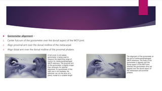 Goniometry of upper limb | PPTX