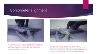 Goniometry of upper limb | PPTX