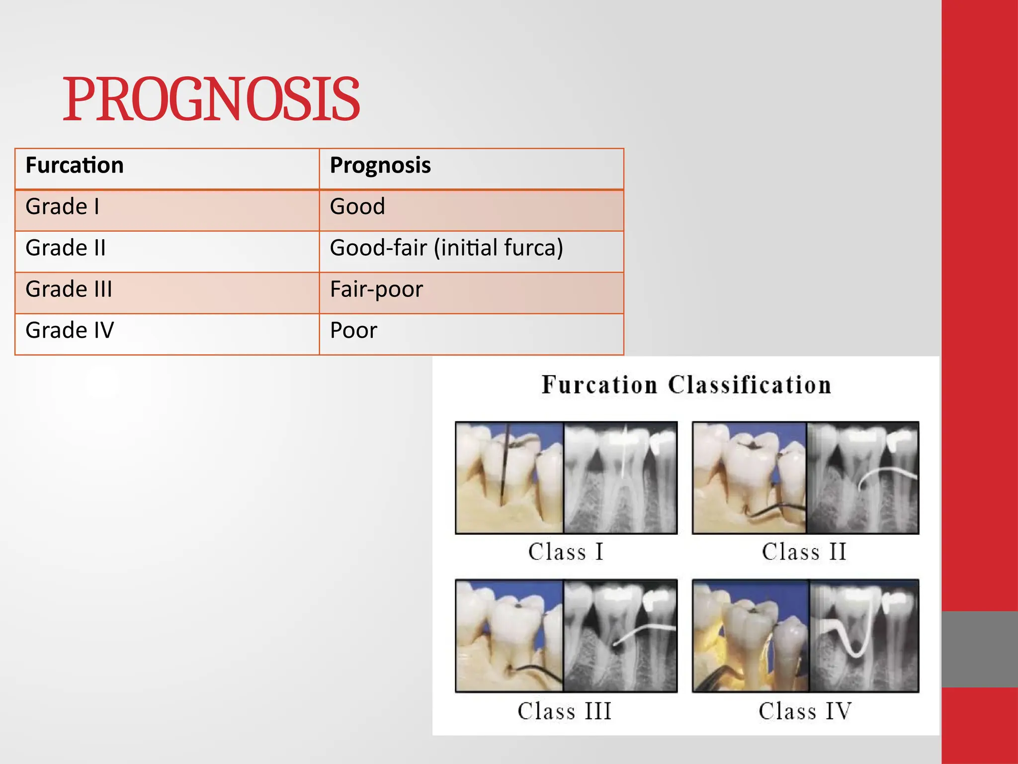 FURCATION INVOLVEMENT COMPLICATIONS IN PERIODONTICS | PPTX
