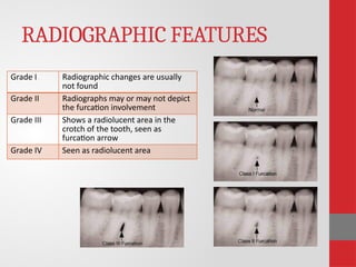 FURCATION INVOLVEMENT COMPLICATIONS IN PERIODONTICS | PPTX