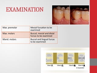 FURCATION INVOLVEMENT COMPLICATIONS IN PERIODONTICS | PPTX