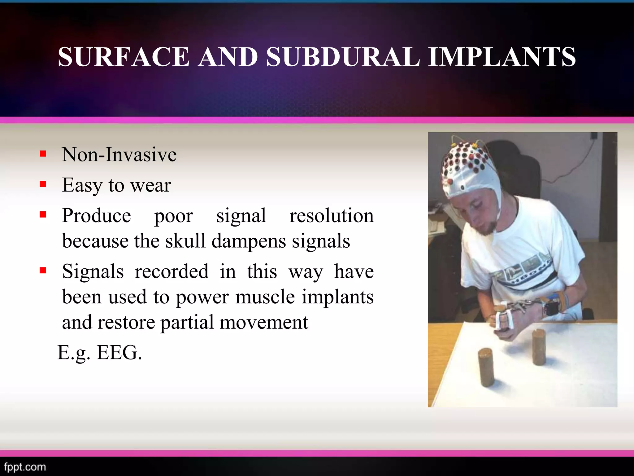 neuro prosthesis | PPTX