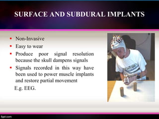 neuro prosthesis | PPTX