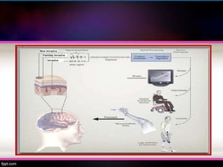neuro prosthesis | PPTX