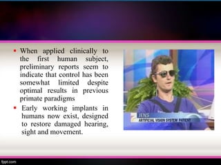 neuro prosthesis | PPTX