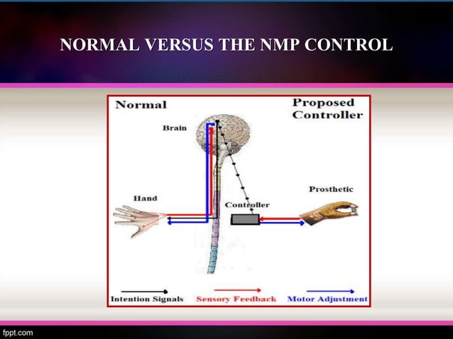 neuro prosthesis | PPTX