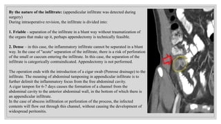 surgery appendicular filltrate about definition to treatment | PPTX