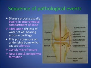 osteoarthritis knee priyank | PPT