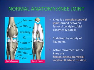 osteoarthritis knee priyank | PPT