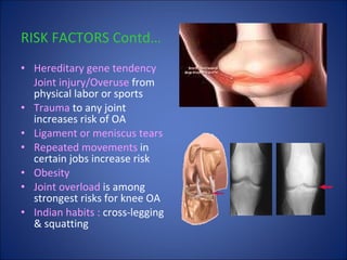 osteoarthritis knee priyank | PPT