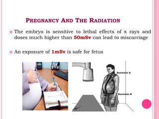 BASIC RADIATION SAFETY AWARENESS | PPTX