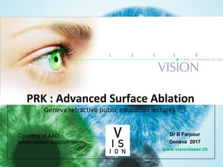 PRK or advanced surface ablation 2017 | ODP