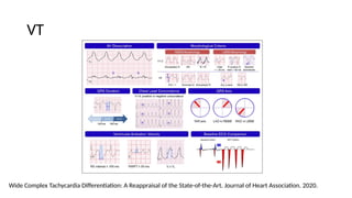 sct svt svt svt svt svt svt svt svts vt svt | PPTX