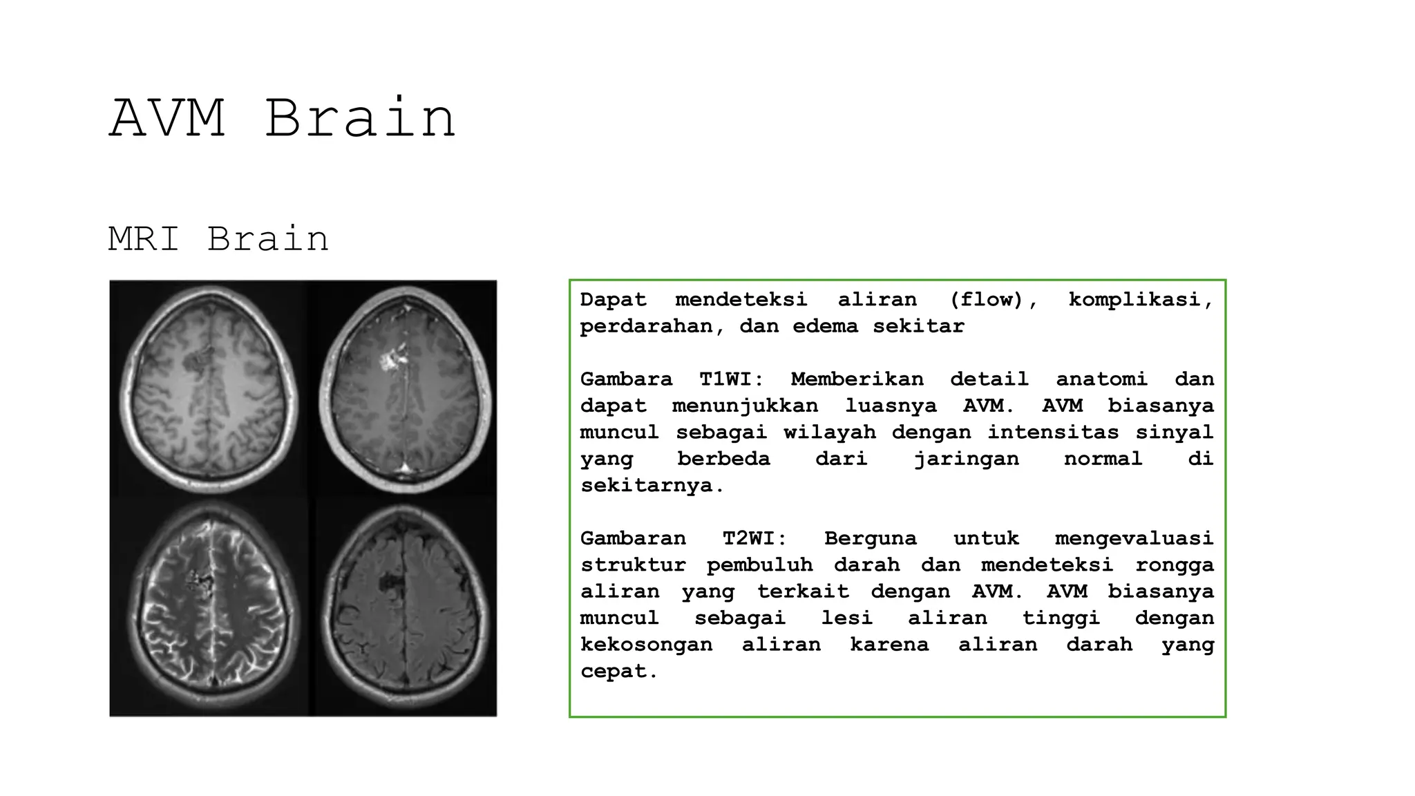 Neuroradiologi mengenai MRI dan CT scan pasien tumor otak | PPT