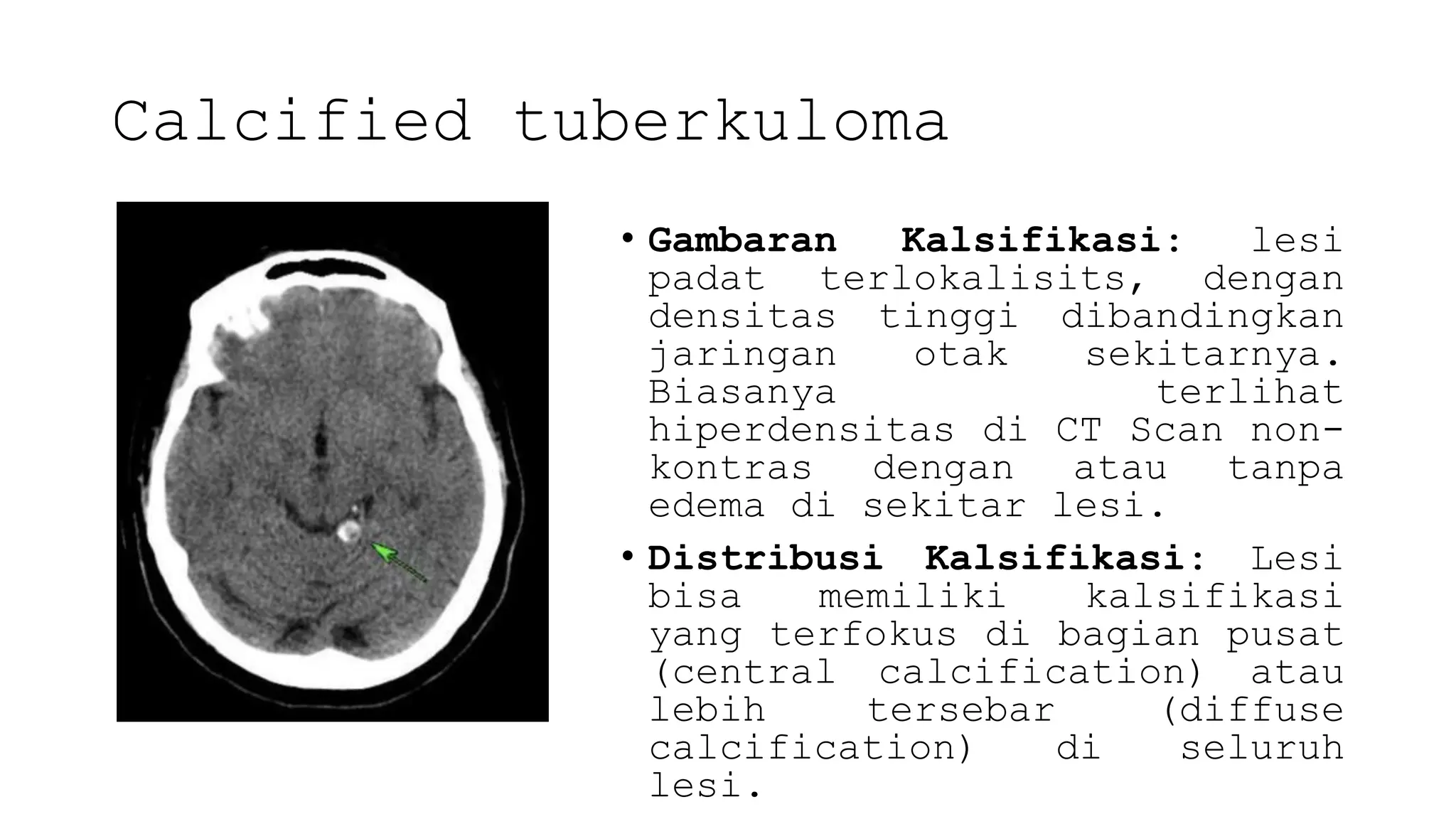 Neuroradiologi mengenai MRI dan CT scan pasien tumor otak | PPT