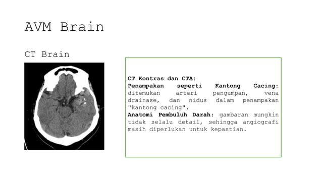 Neuroradiologi mengenai MRI dan CT scan pasien tumor otak | PPT