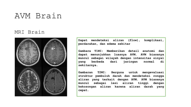 Neuroradiologi mengenai MRI dan CT scan pasien tumor otak | PPT