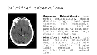 Neuroradiologi mengenai MRI dan CT scan pasien tumor otak | PPT