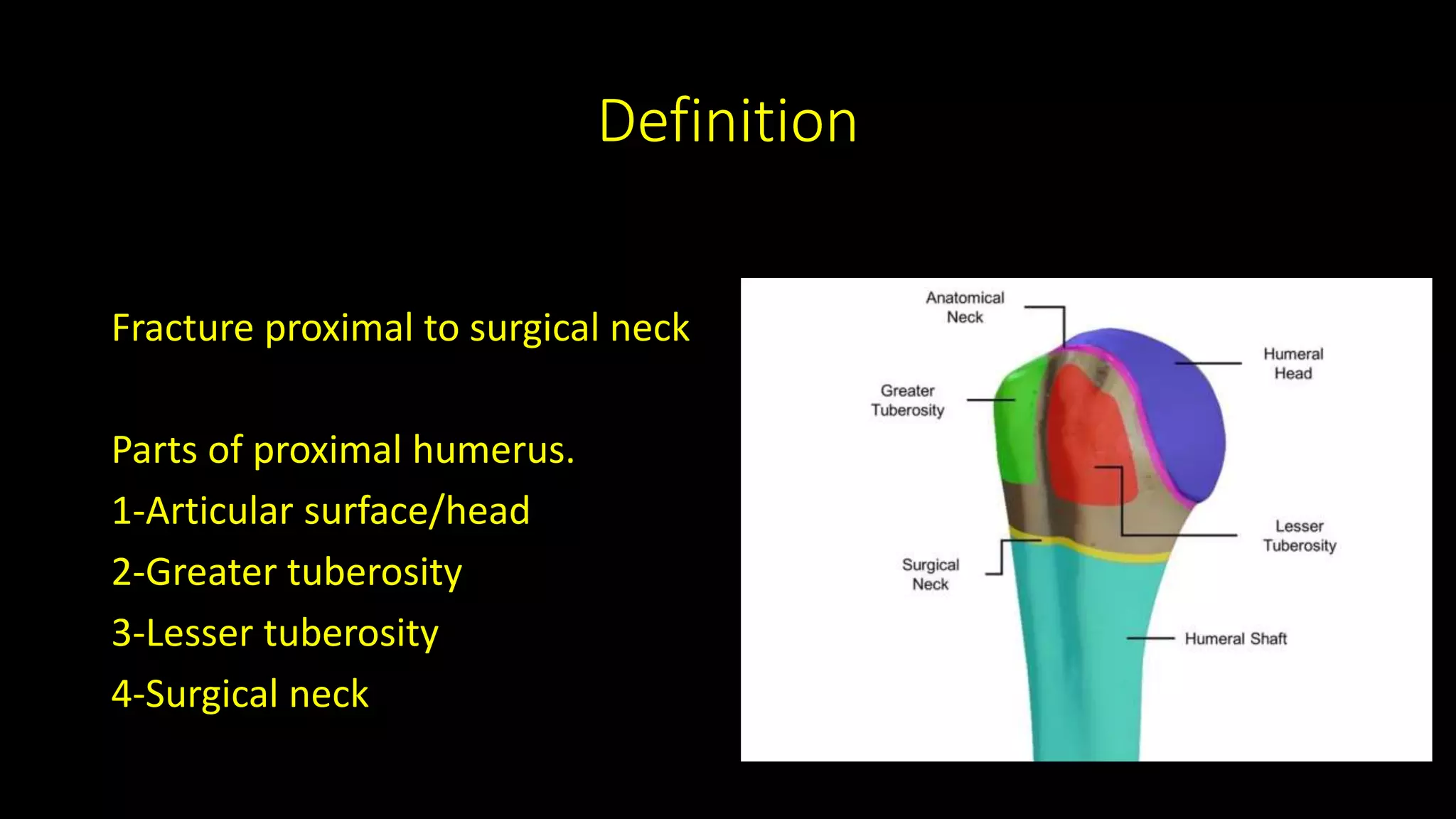 Proximal humerus fracture .pptx