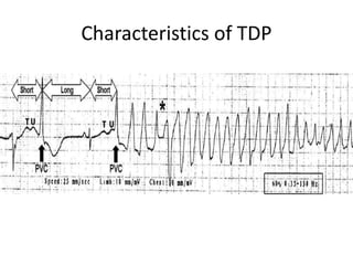 Proarrhythmia | PPTX