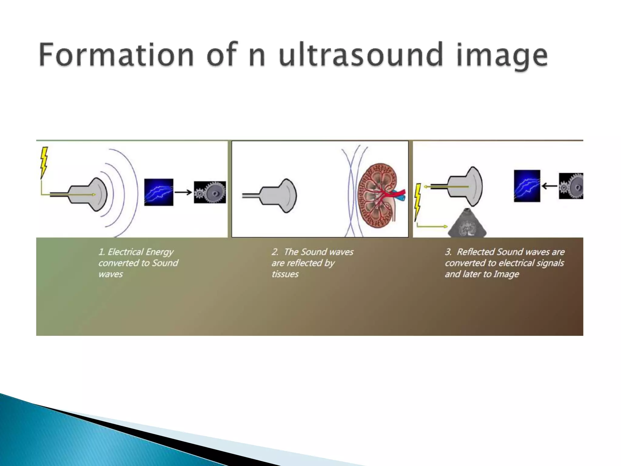 Probe construction, types and usg artefacts | PPT