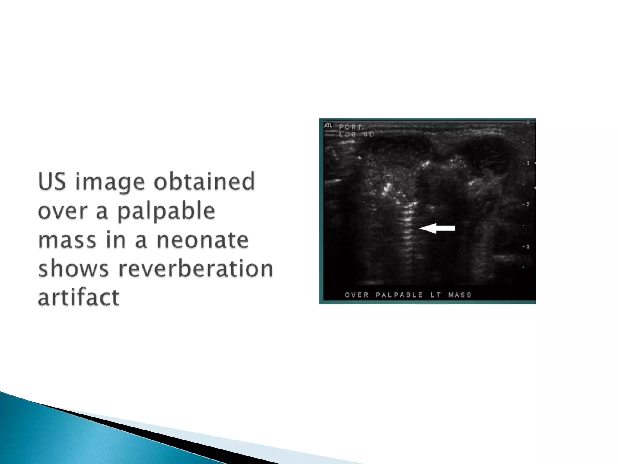 Probe construction, types and usg artefacts | PPT