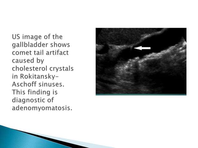 Probe construction, types and usg artefacts | PPT