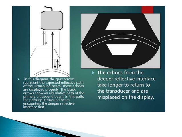 Probe construction, types and usg artefacts | PPT