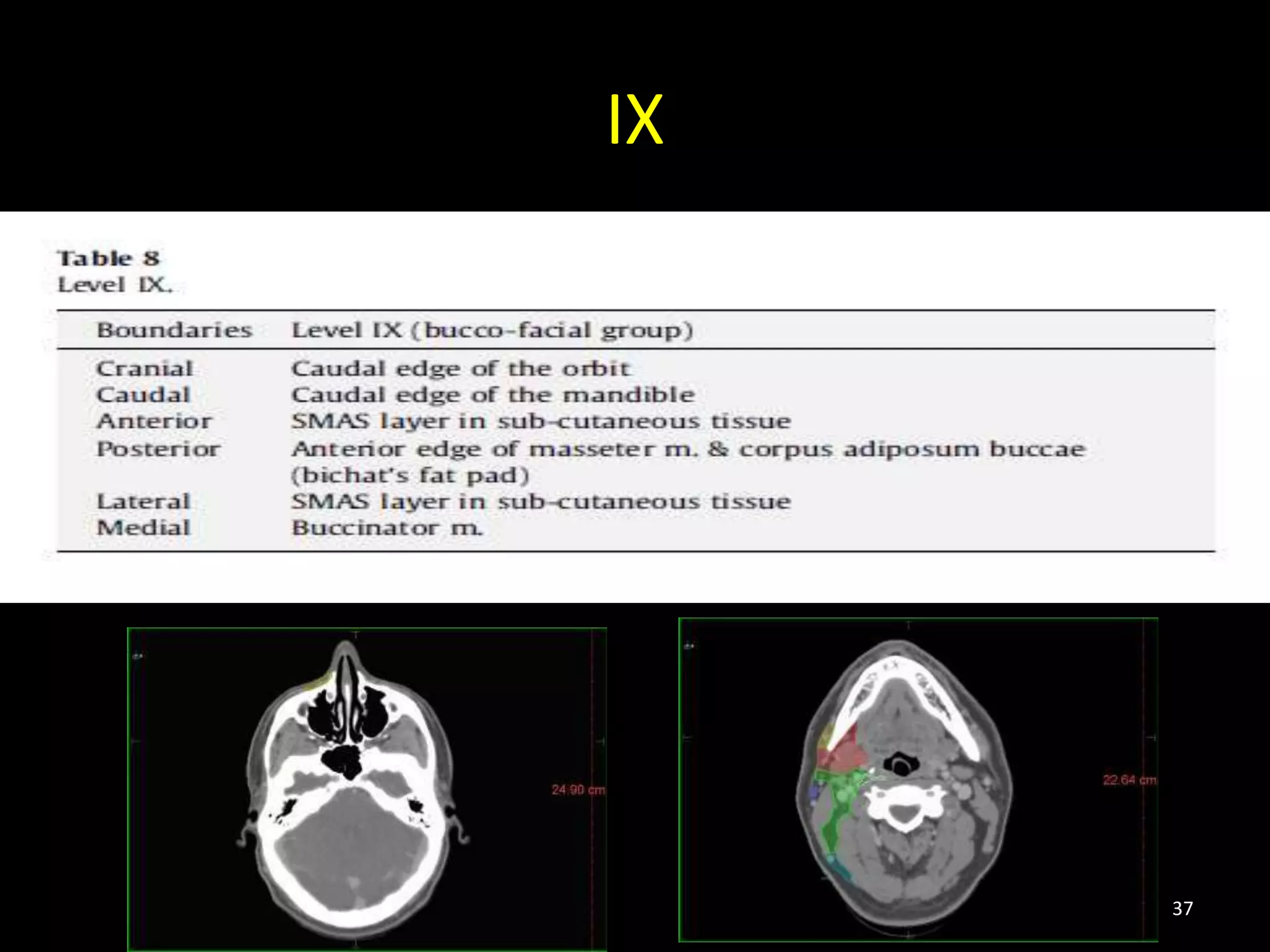 Delineation Of Nodal Volumes And Oars A Problem Based Approach Ppt