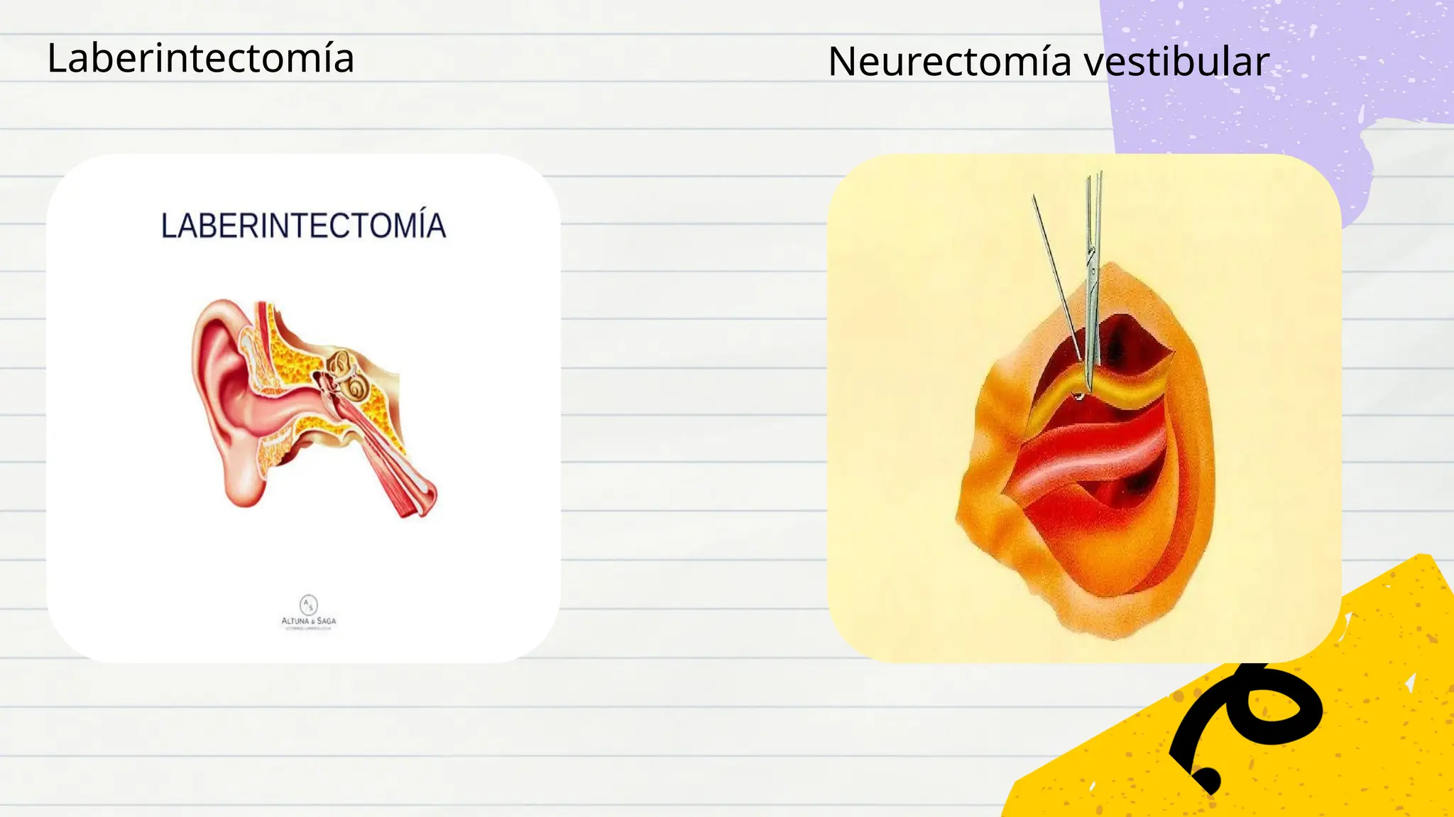 Problemas Que Pueden Presentarse En El Oído Pptx