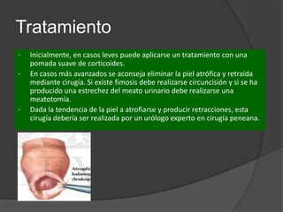 Problemas del prepucio abr.2013