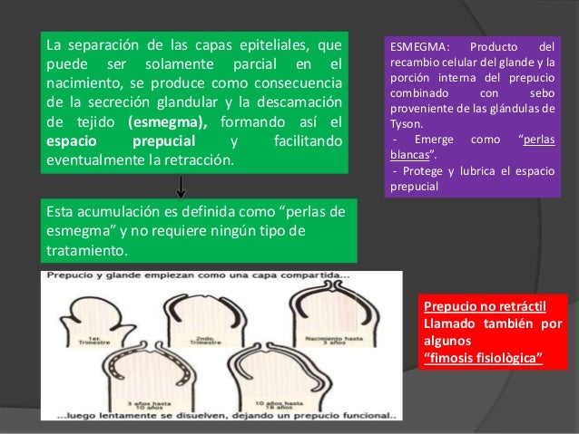 Problemas del prepucio abr.2013