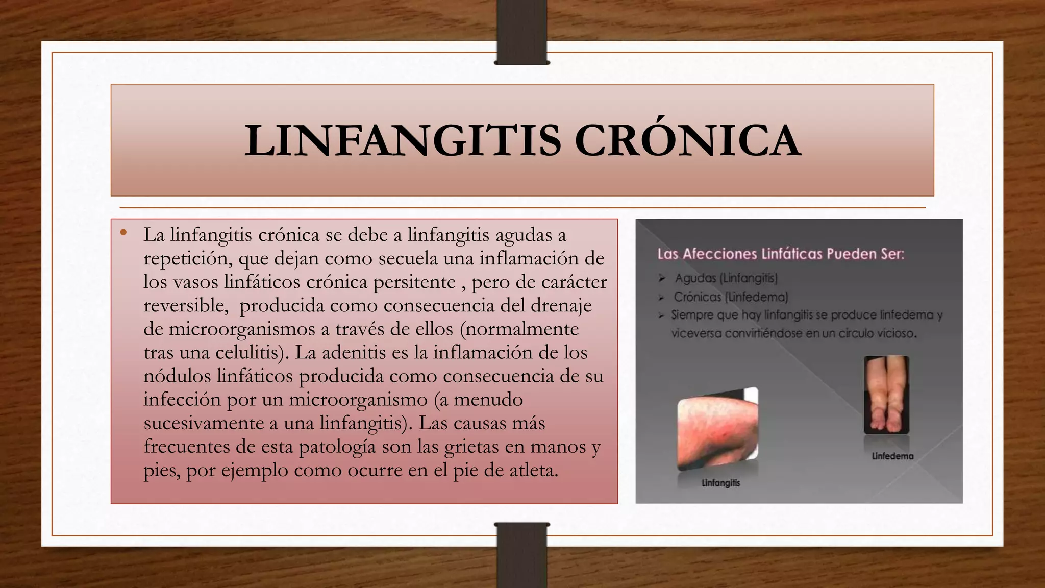 Problemas del sistema linfático.pptx