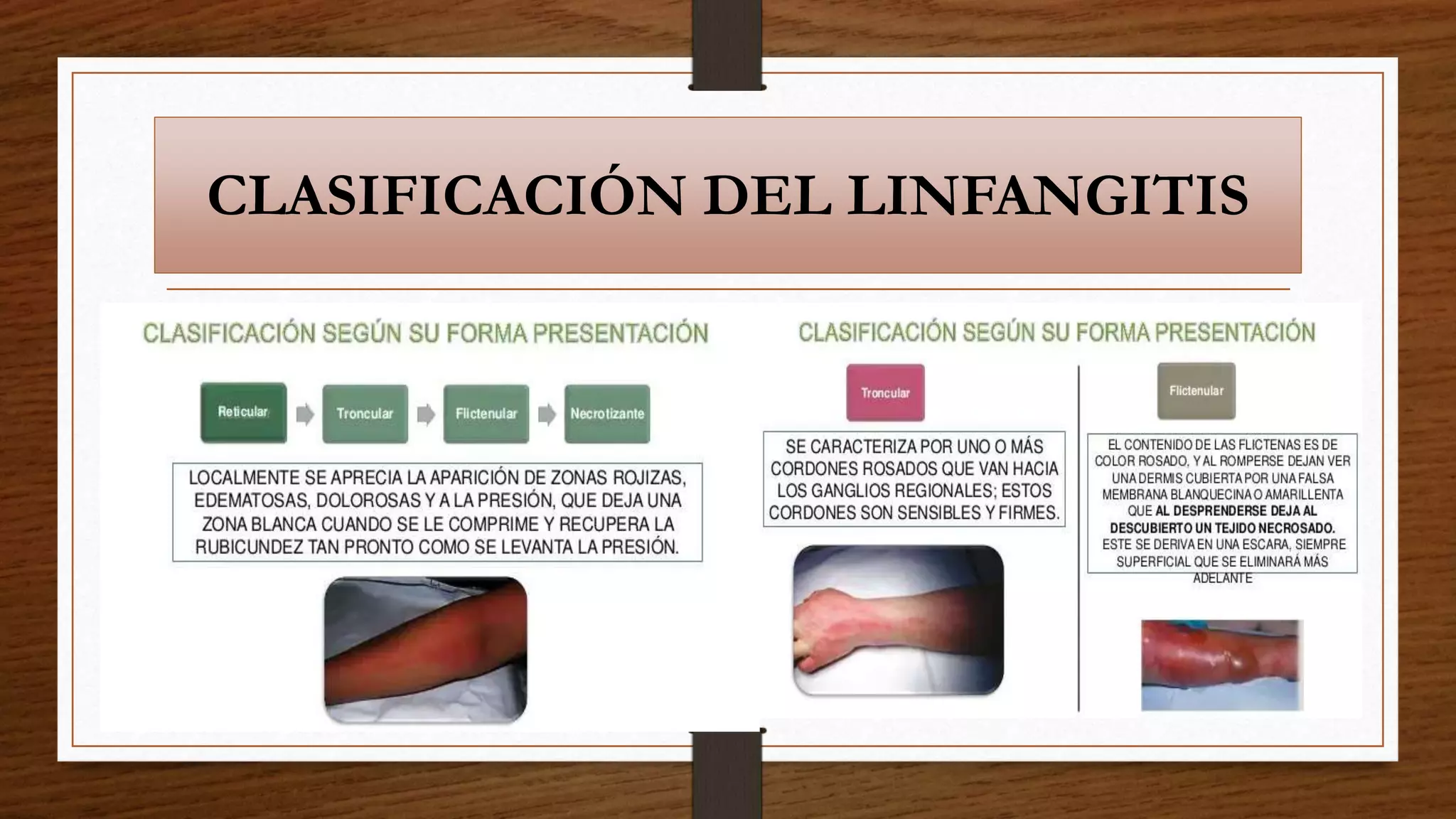 Problemas del sistema linfático.pptx