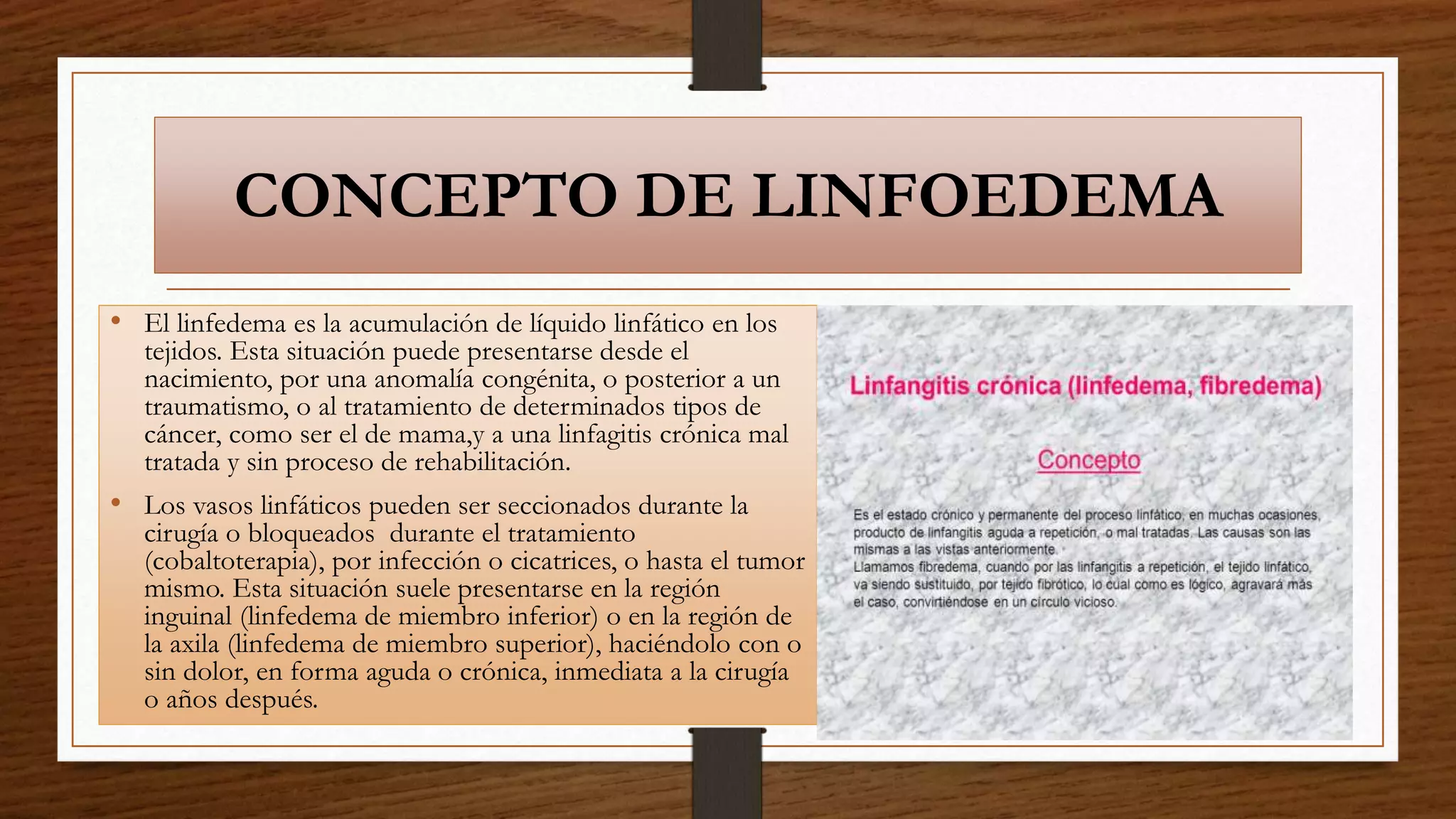 Problemas del sistema linfático.pptx