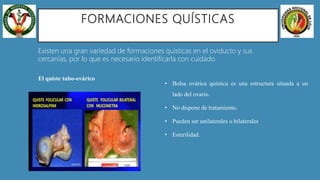 Patologias de los oviductos | PPTX