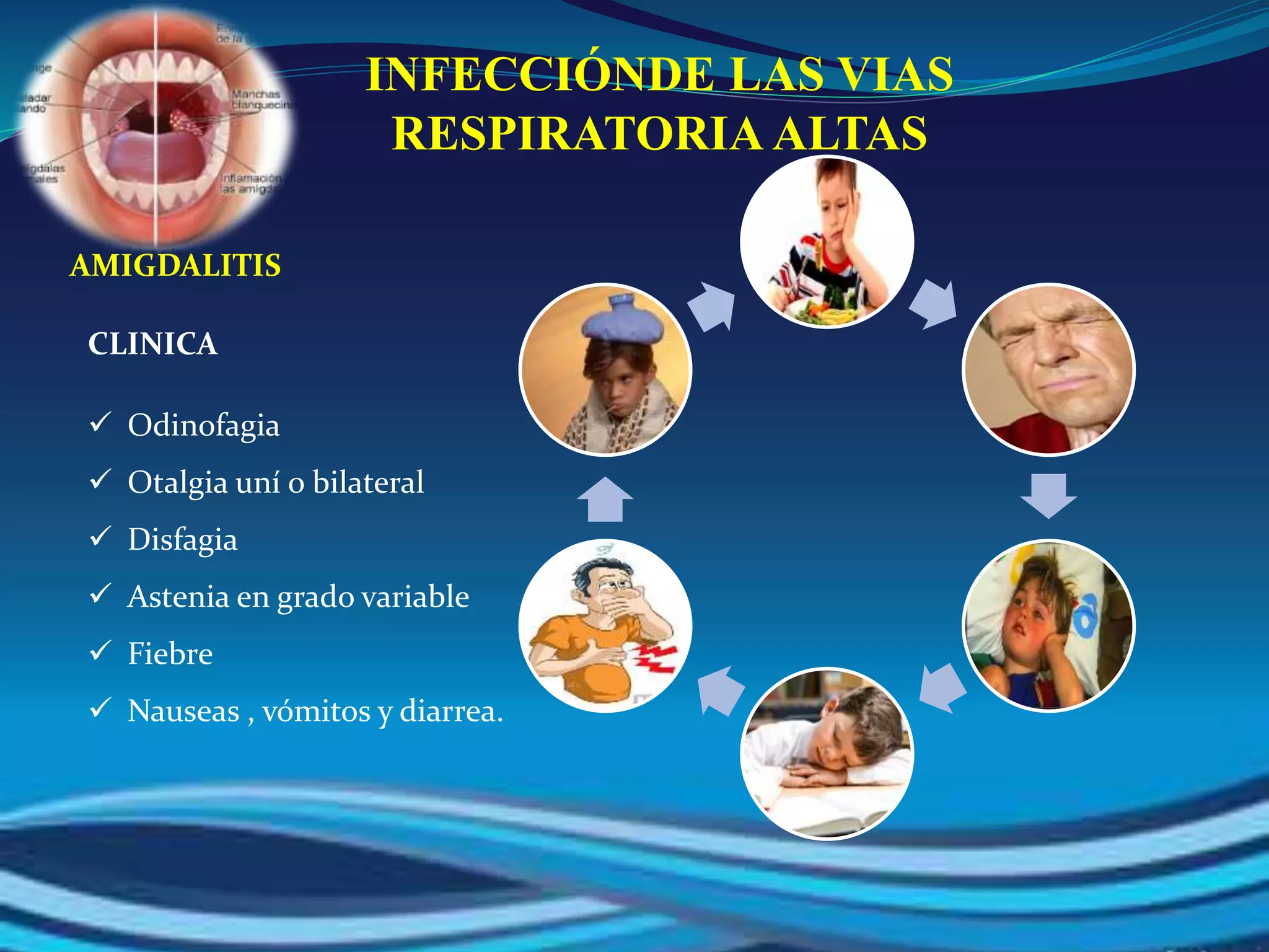 Infecciones Respiratórias Agudas Ppt
