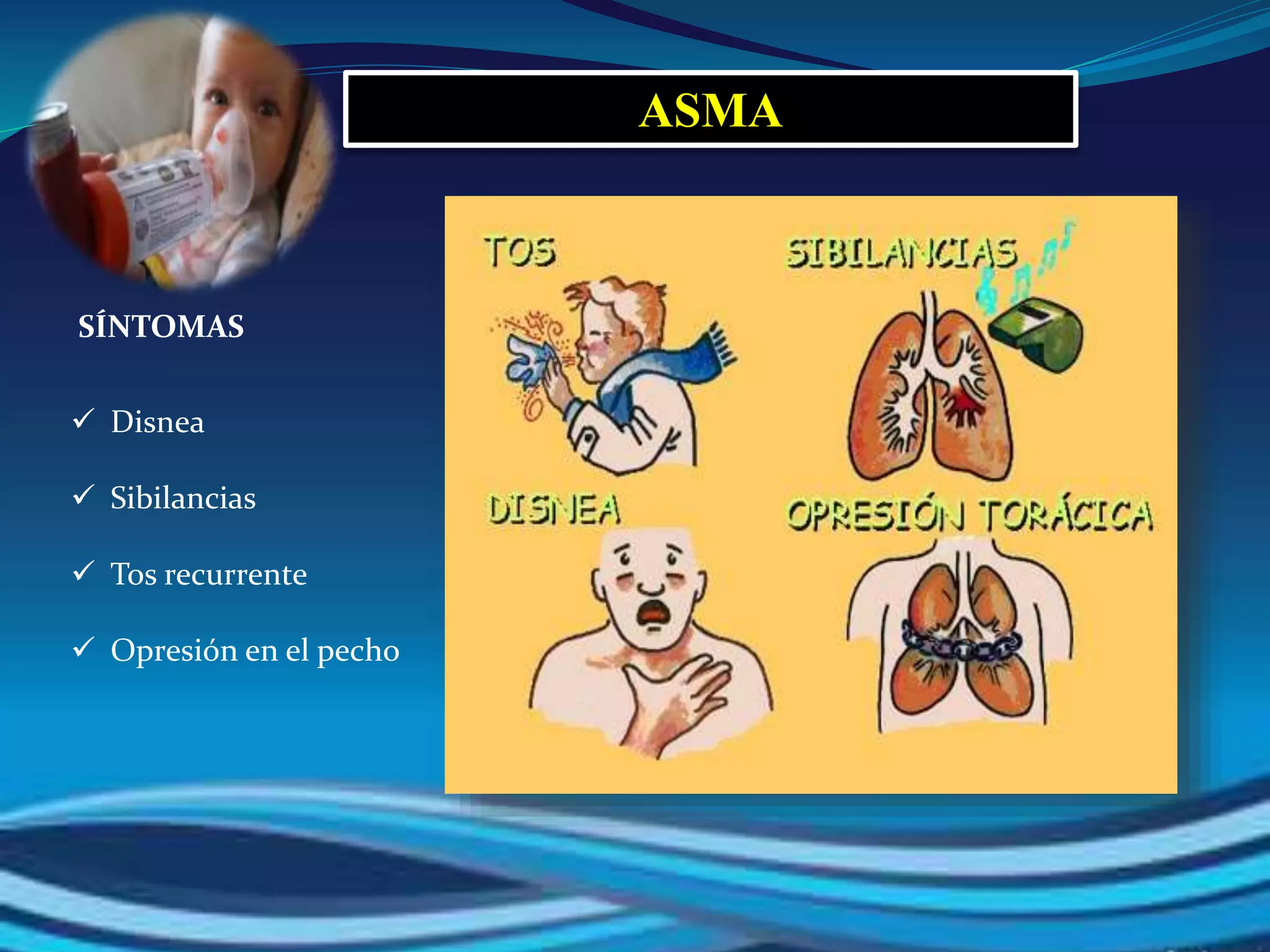 Infecciones Respiratórias Agudas Ppt