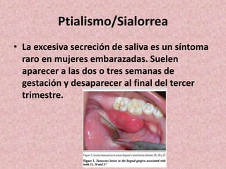 Problemas odontologicos materno ii | PPTX